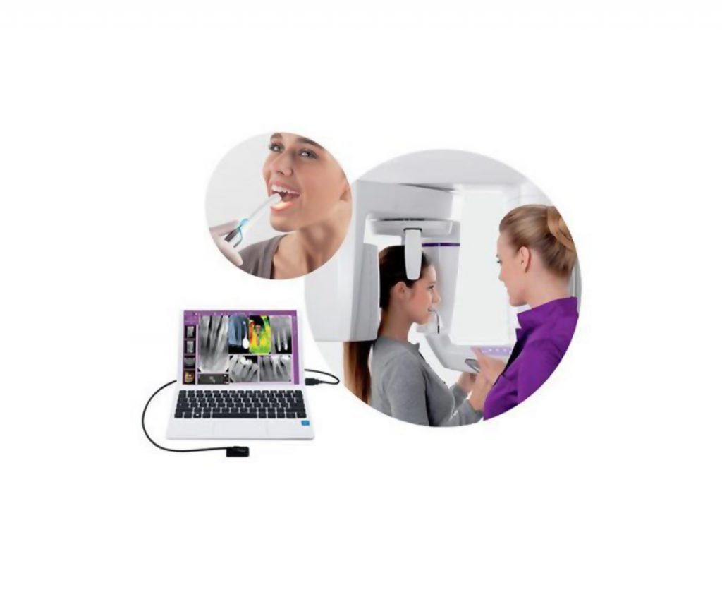 MyRay is a Worldwide Name – Biodent